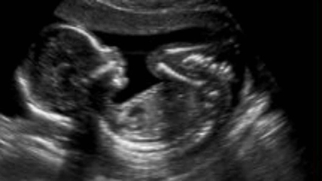 El curioso caso del nasciturus y el Tribunal Constitucional – El Toro TV